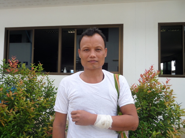 Success! Myint Naing from Burma raised $1,500 to treat his broken arm ...