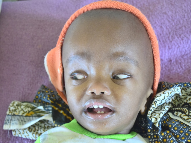 Success! Hamida from Tanzania raised $775 to fund life-changing brain ...