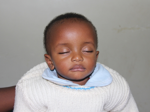 Success! Gedion from Kenya raised $423 to fund hernia surgery. | Watsi