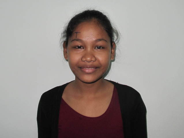 Success! Srey Leak from Cambodia raised $198 to fund eye surgery. | Watsi