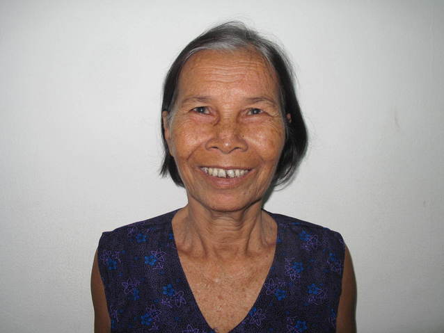 Success! Samun from Cambodia raised $398 to fund cataract surgery. | Watsi