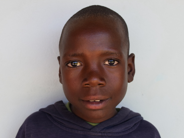 Success! Fadhili from Tanzania raised $890 to fund clubfoot treatment ...