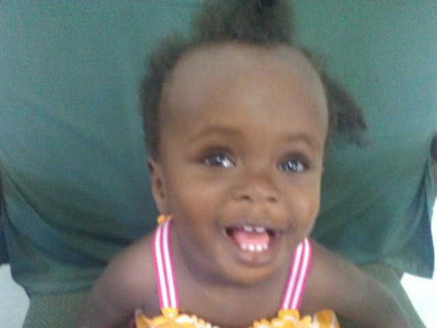 Noradia from Haiti raised $1,260 to get healthy. | Watsi