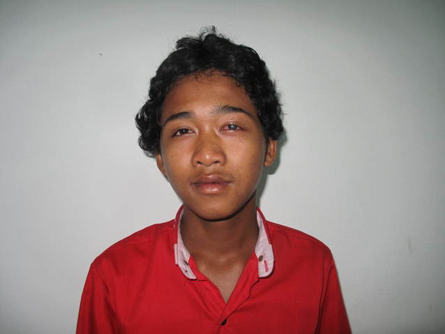 Success! Chhan from Cambodia raised $211 to fund cataract surgery. | Watsi