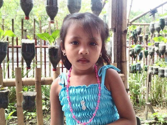 Success! Jonalyn from the Philippines raised $1,500 to fund corrective ...