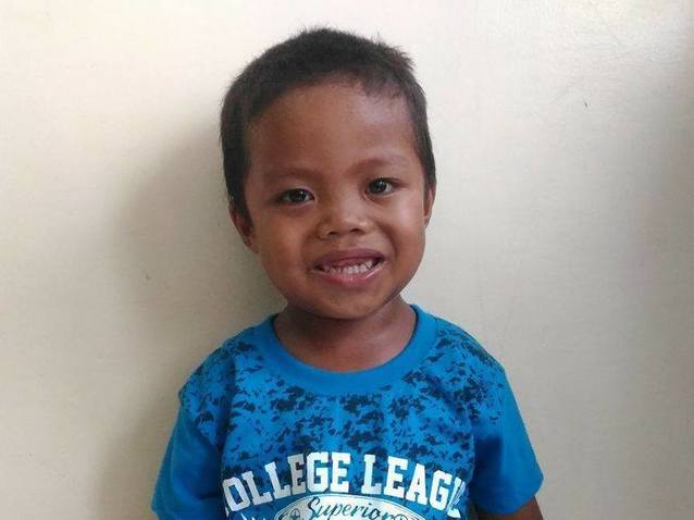 Renz from the Philippines raised $1,500 to fund corrective surgery. | Watsi