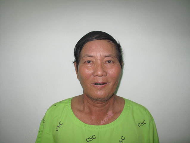 Success! Sothy from Cambodia raised $398 to fund cataract surgery. | Watsi