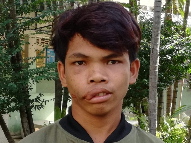 Success! Panha from Cambodia raised $220 to fund a mass removal ...
