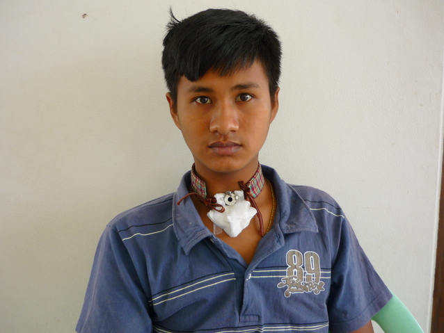 Success Nan Htet From Thailand Raised 469 To Fund A Ct Scan Watsi
