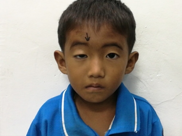 Success! Ratanak from Cambodia raised $292 to fund eye surgery. | Watsi