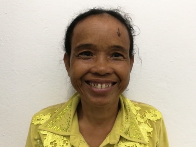 Success! Sokhon from Cambodia raised $398 to fund cataract surgery. | Watsi