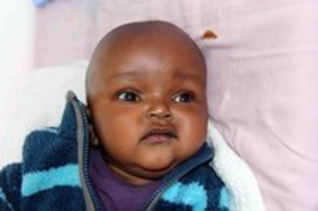 Clement from Kenya raised $980 to drain the excess fluid from his skull ...