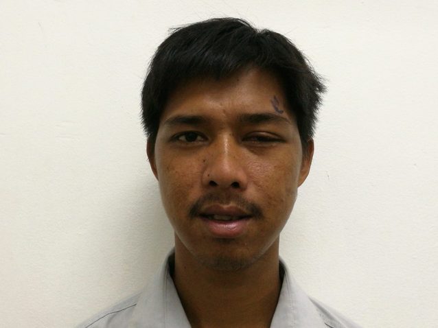 Success! Sophen from Cambodia raised $229 to fund sight-restoring eye surgery. | Watsi