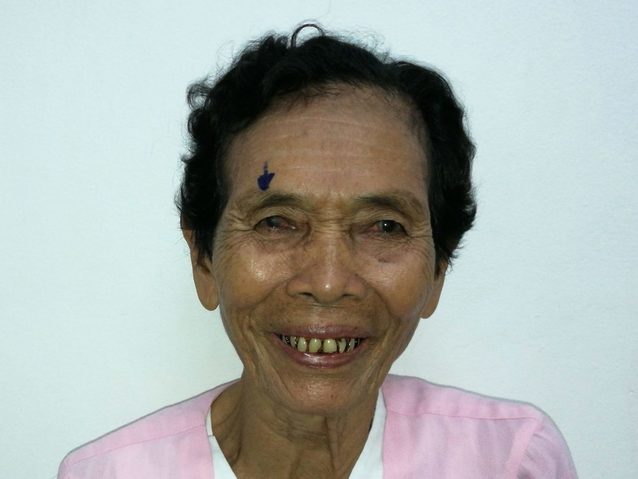 Success! Chean from Cambodia raised $216 to fund sight-restoring ...