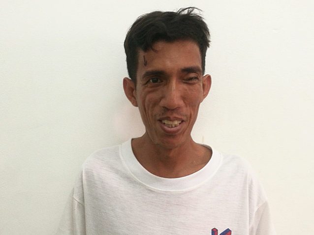 Success! Pheak from Cambodia raised $648 to fund retinal detachment ...