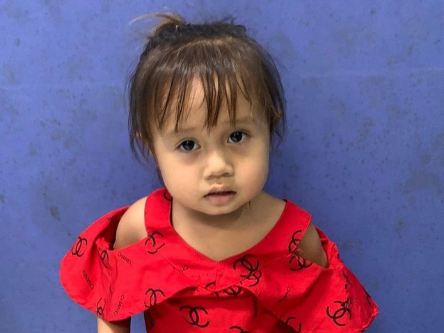 Success! Socheata from Cambodia raised $495 to fund burn contracture ...