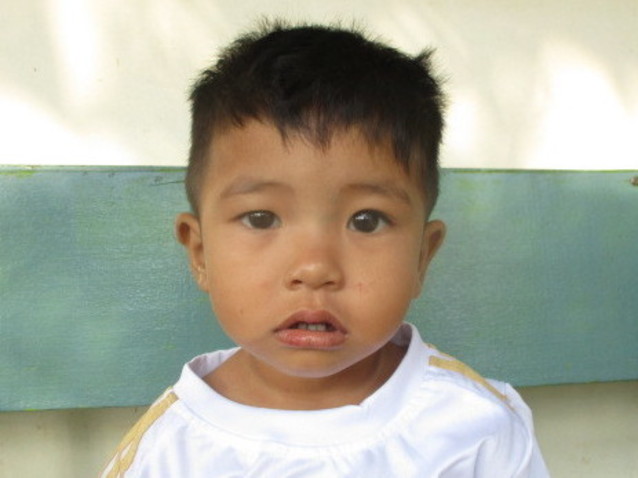 Success! Vathana from Cambodia raised $444 for surgery on his hand. | Watsi