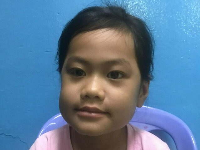 Success! Sok Heng from Cambodia raised $572 to fund a special nerve and ...