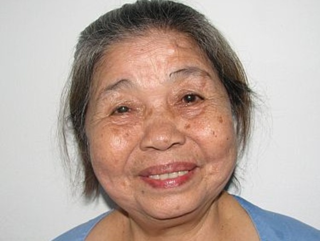 Teang from Cambodia raised $150 to improve her vision. | Watsi