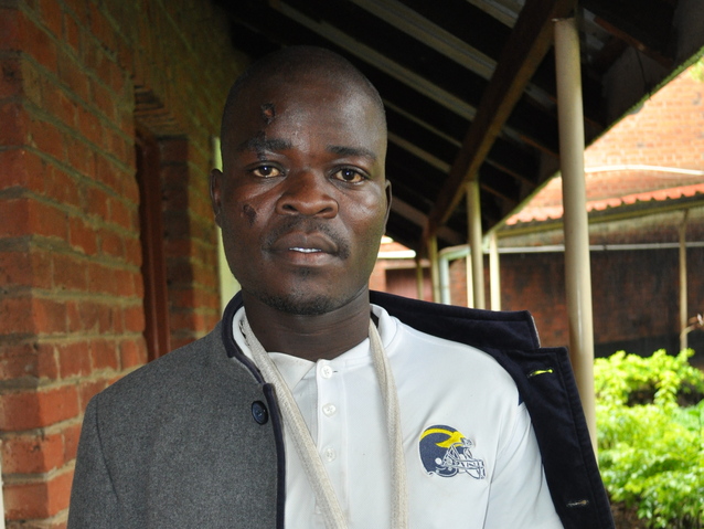 Success! Dickson from Malawi raised $525 to fund arm surgery. | Watsi