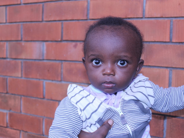 Success! Malcom from Uganda raised $230 to fund corrective surgery for ...