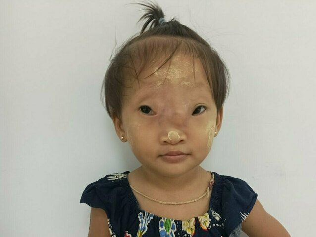 Success! Kyawt from Burma raised $693 to fund a CT scan. | Watsi