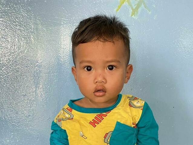 Success! Sambath from Cambodia raised $395 to fund burn repair surgery ...