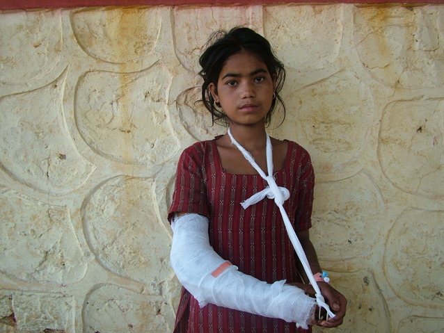 Suma from Nepal raised $205 so she can move her arm again. | Watsi