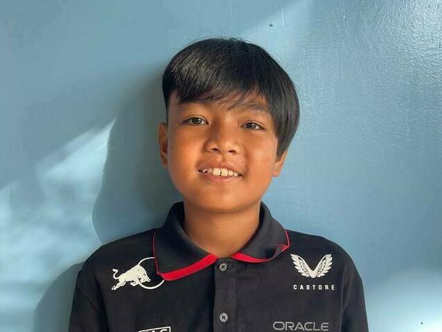 Success! Kakvey from Cambodia raised $445 to fund burn contracture release surgery. | Watsi