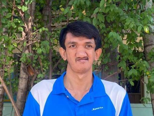 Success! Bunleng from Cambodia raised $387 to fund ear surgery so he can regain his hearing. | Watsi