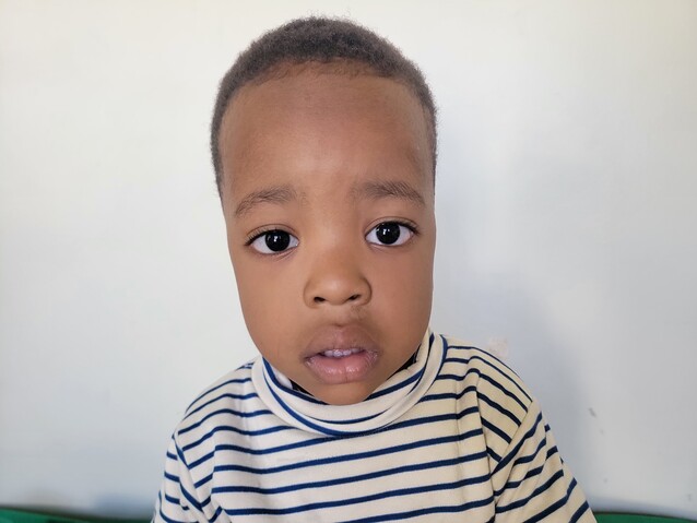 Success! Sahir from Tanzania raised $341 to fund clubfoot treatment and ...