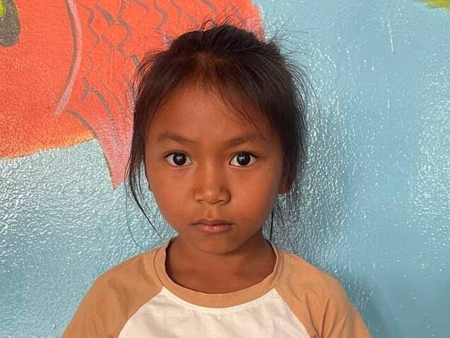 Success! Socheata from Cambodia raised $495 to fund burn contracture ...