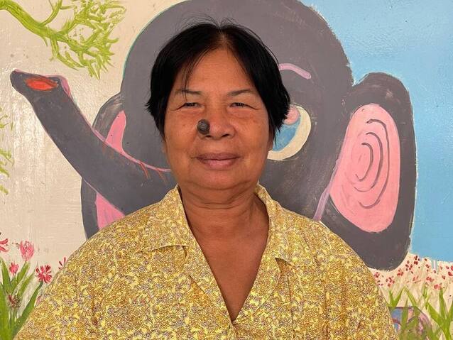 Success! Phally from Cambodia raised $173 to fund skin cancer removal ...