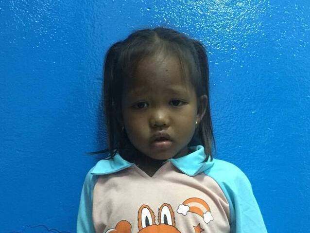 Success! Srey Nith from Cambodia raised $462 to fund corrective surgery ...