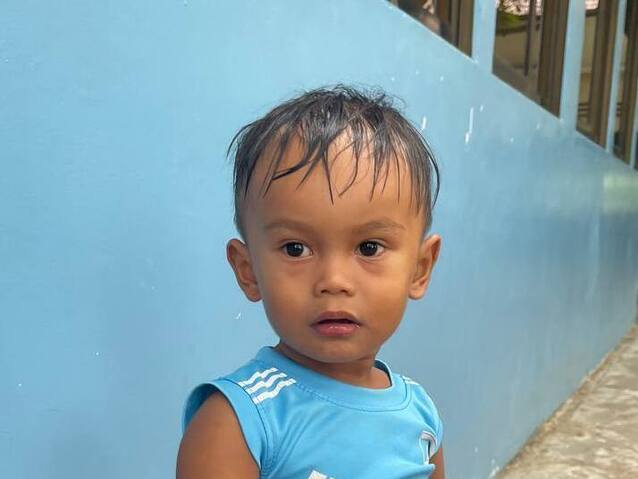 Panha Pich is a two-year-old boy from Cambodia who needs $379 to fund corrective surgery on his ...