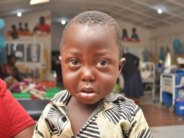 Success! Stonard from Malawi raised $421 to fund hernia repair surgery ...