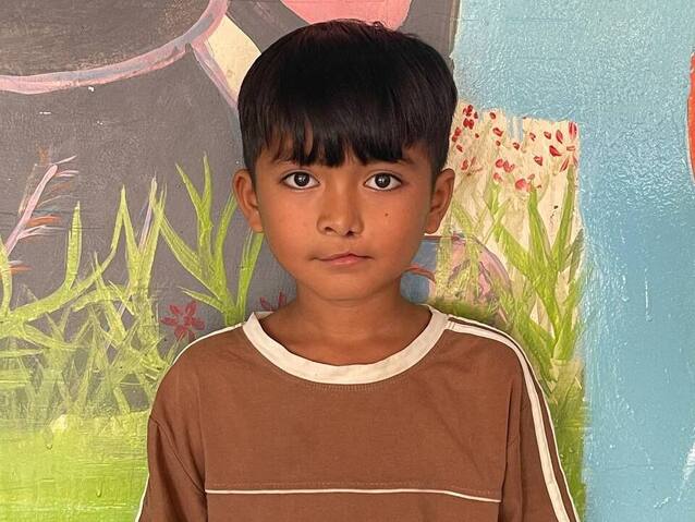 Success! Safik from Cambodia raised $665 to fund an alveolar bone graft ...