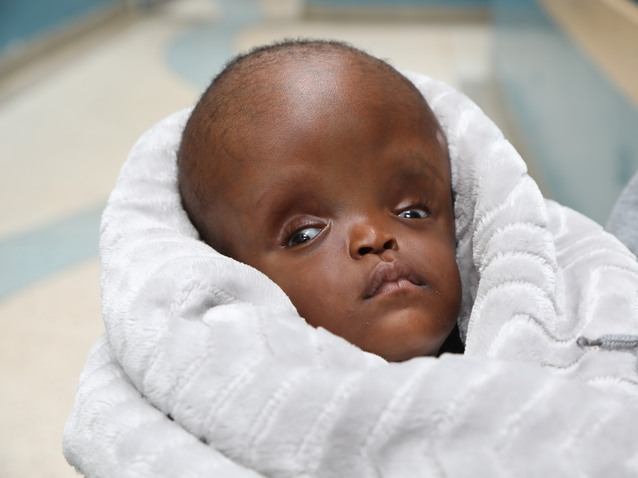 Success! Randell from Kenya raised $719 to fund surgery to treat ...
