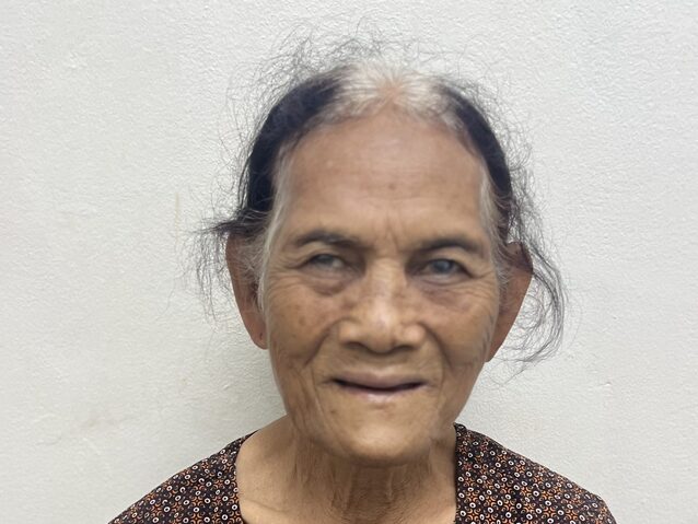 Success! Soeun from Cambodia raised $213 to fund cataract surgery. | Watsi