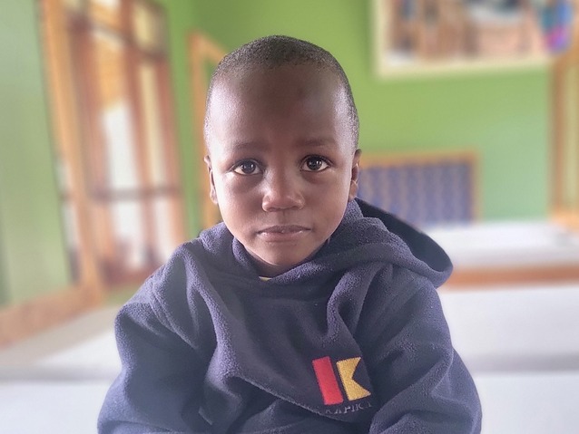 Success! Issa from Tanzania raised $832 to fund burn contracture ...