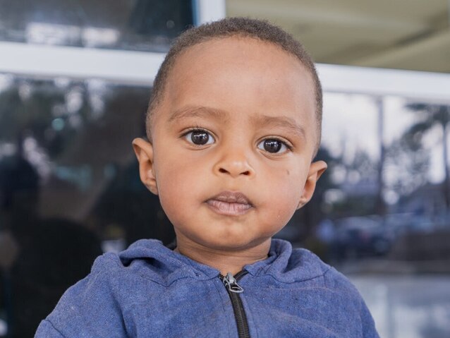 Success! Yunus from Ethiopia raised $1,293 to fund corrective surgery ...