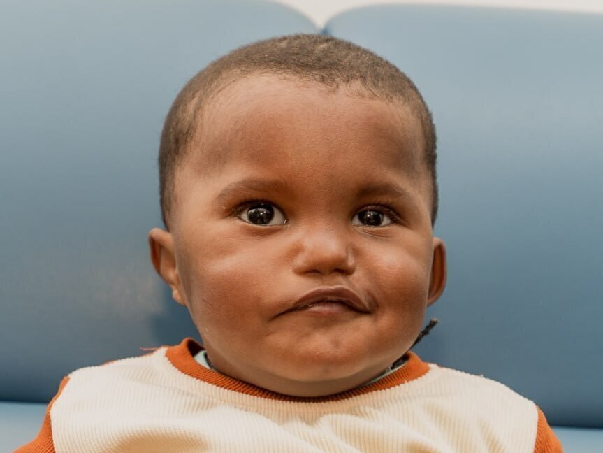 Surafel is a toddler from Ethiopia who needs $1,073 to fund corrective ...