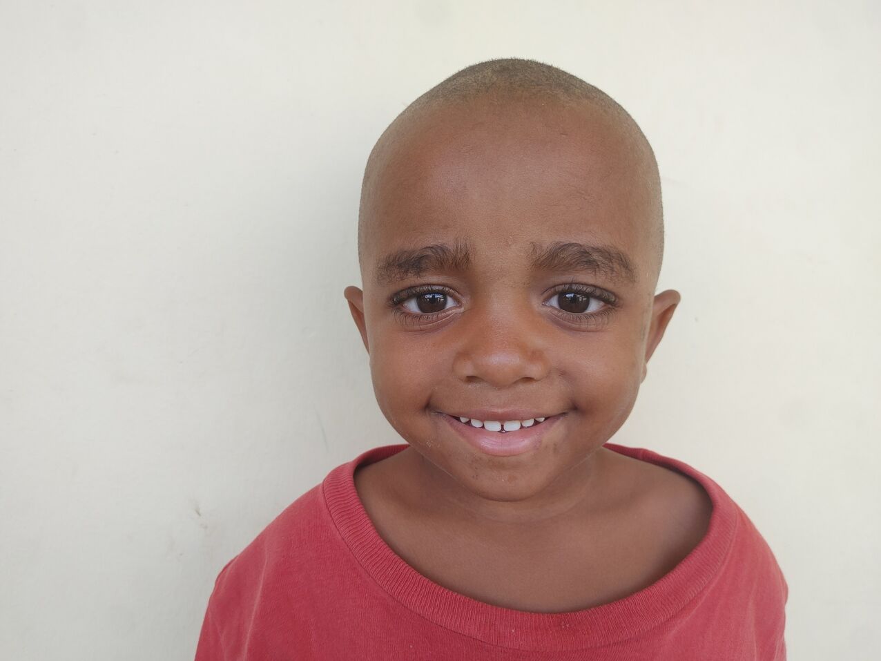 Seleman is a preschooler from Tanzania who needs $777 to fund knee ...