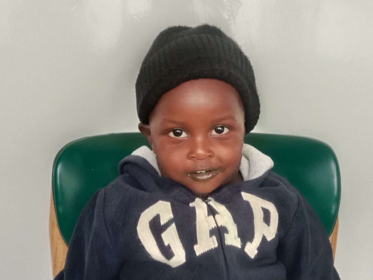 Success! Jadon from Kenya raised $483 to fund corrective surgery for a ...