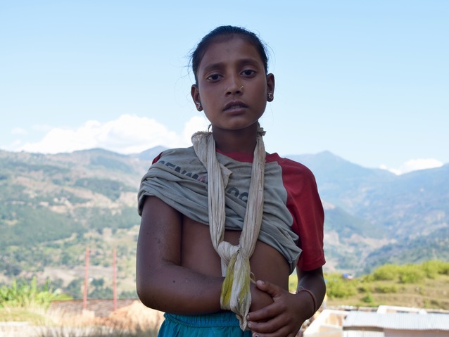 Khema from Nepal raised $224 to treat a fractured hand. | Watsi