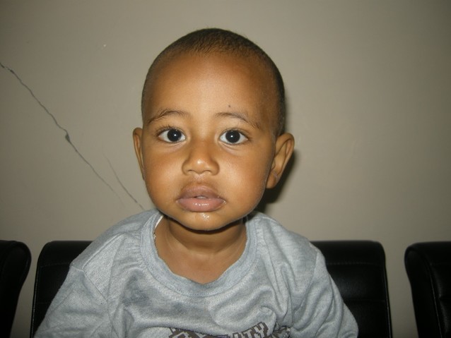 Success! Abubeker from Ethiopia raised $1,155 to pass urine comfortably ...