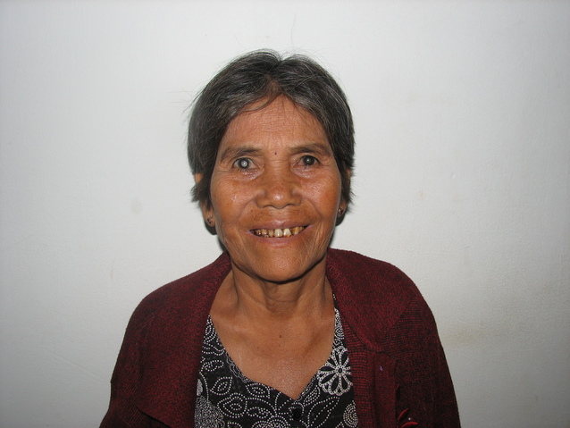 Success! Chhin from Cambodia raised $225 for surgery to restore her ...
