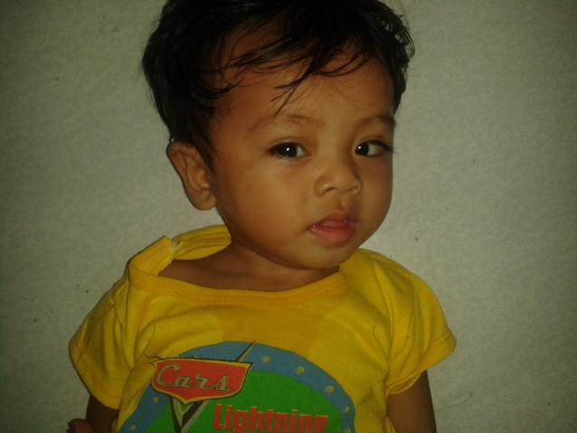 Success! Archiel from the Philippines raised $1,500 for clubfoot ...