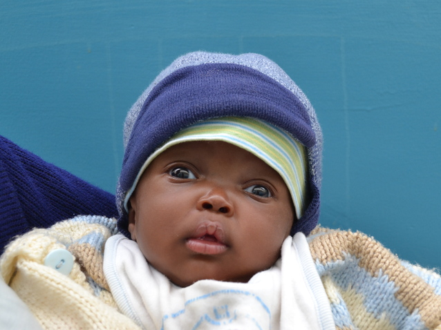 Success! Faour from Kenya raised $615 to drain excess fluid from her ...