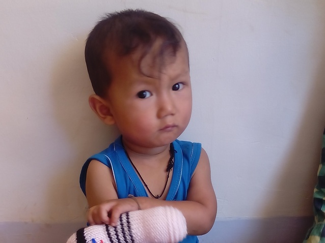 Dah Htoo from Burma raised $1,500 to treat burns on his hand. | Watsi